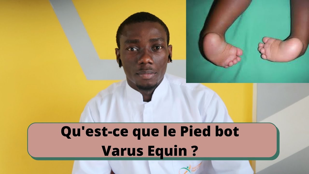Qu'est-ce que le Pied Bot Varius Equin ? - YouTube