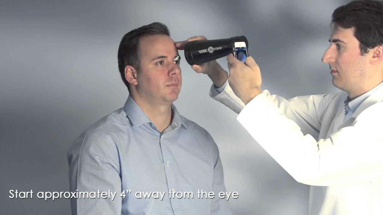 Volk iNview - Setup & Imaging Tutorial - YouTube