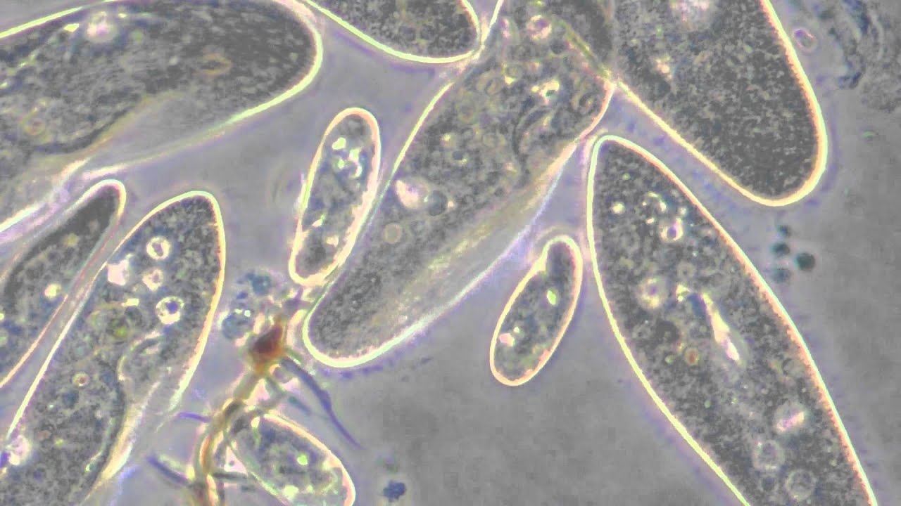 PARAMECI IN CONTRASTO DI FASE - YouTube