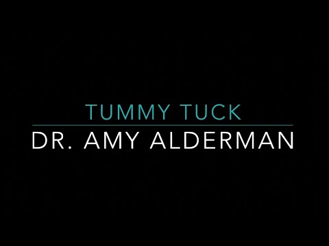 Tummy Tuck with Dr. Amy Alderman - YouTube