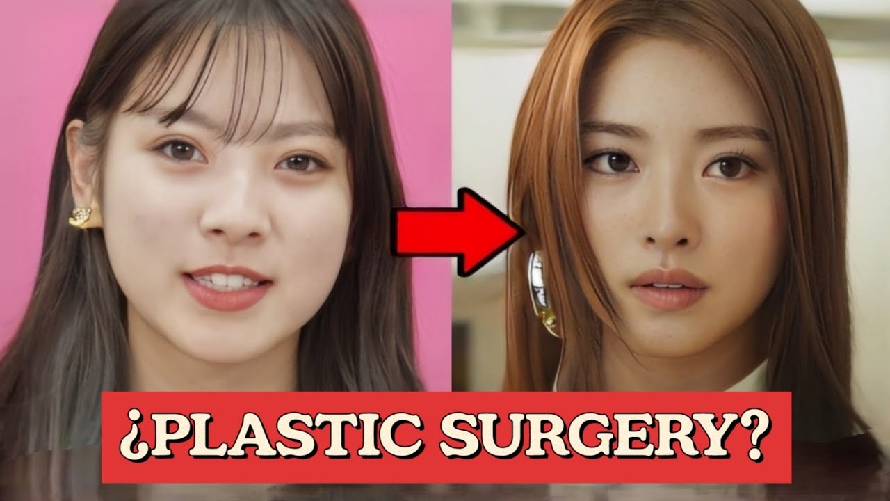 PLASTIC SURGERY? THE MEOVV MEMBER UNDER ATTENTION FOR HER NEW ...