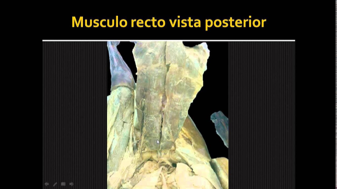 musculo recto del abdomen - YouTube