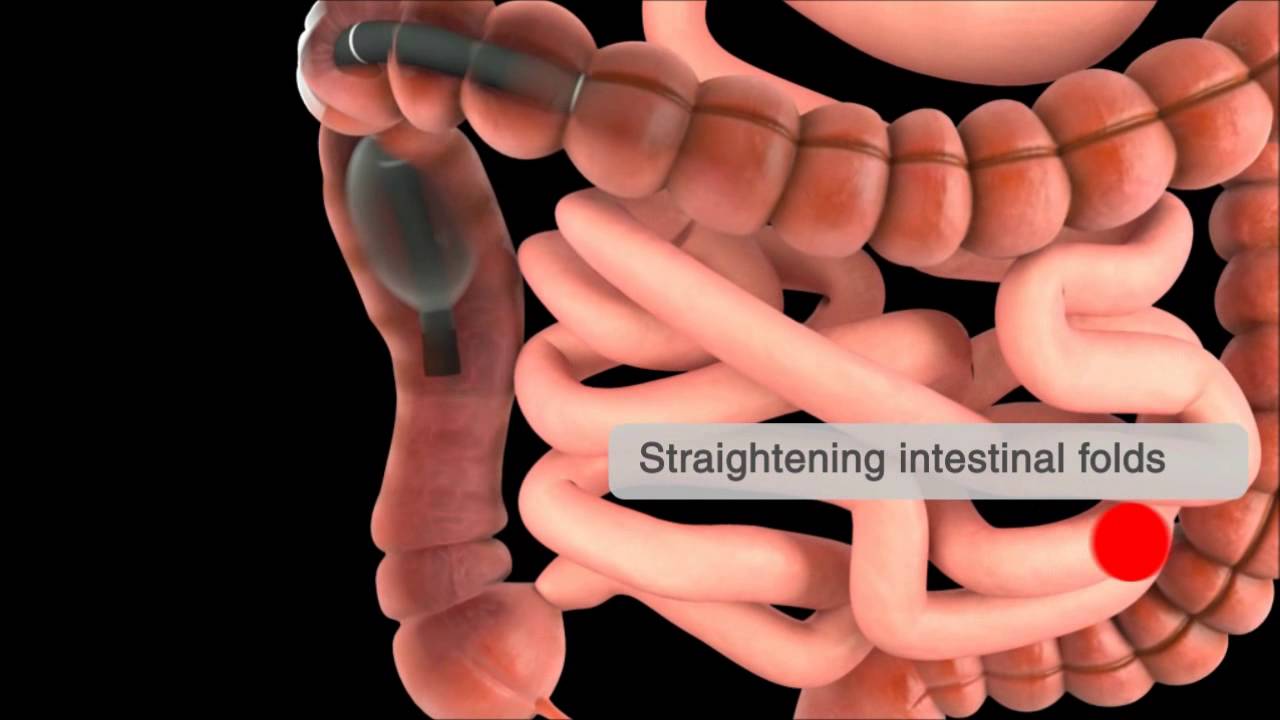 G-EYE™ HD+ endoscopes - YouTube