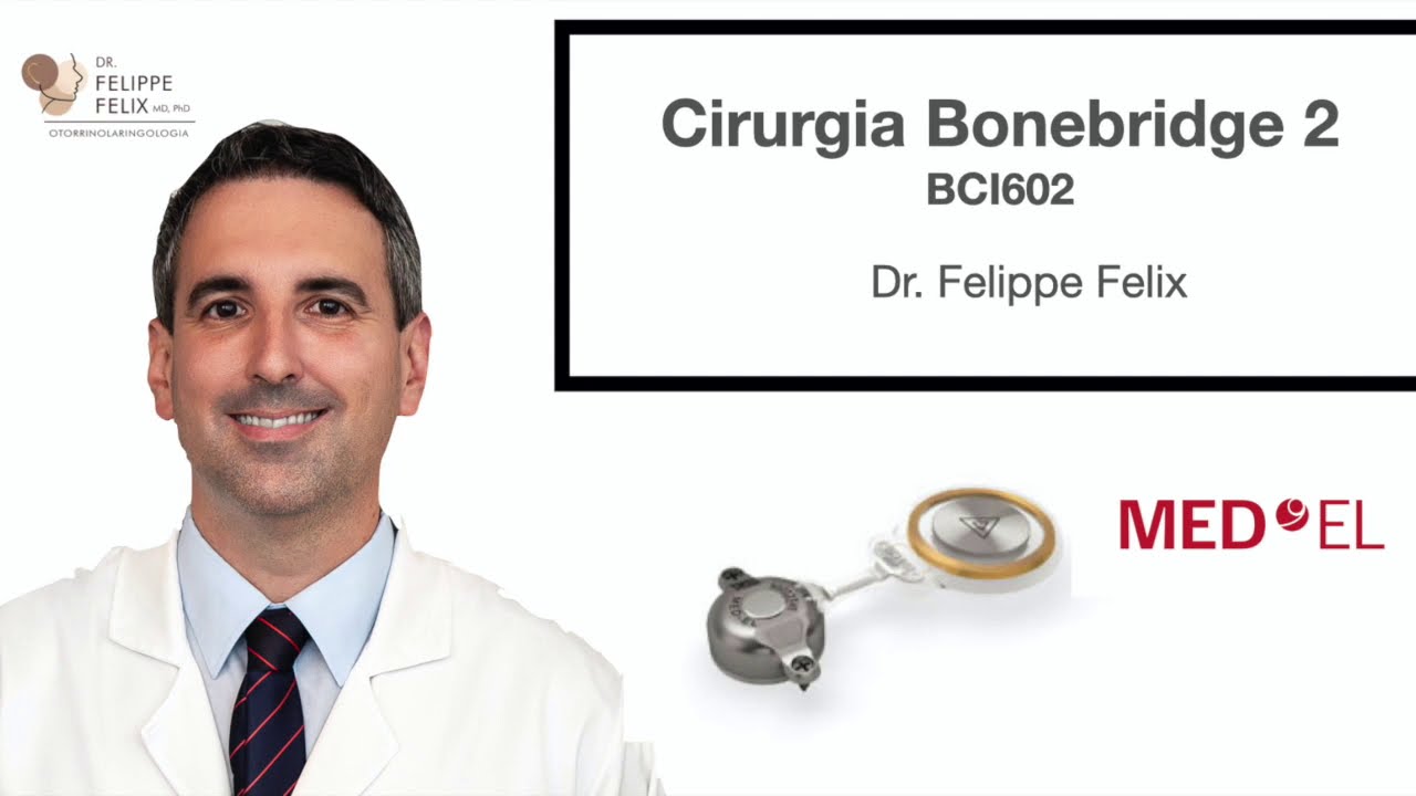 Cirurgia do Bonebridge 2 - passo a passo - YouTube