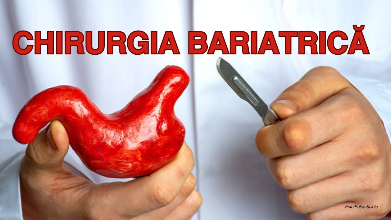 Operația de micșorare a stomacului. Tipurile de intervenții utilizate ...