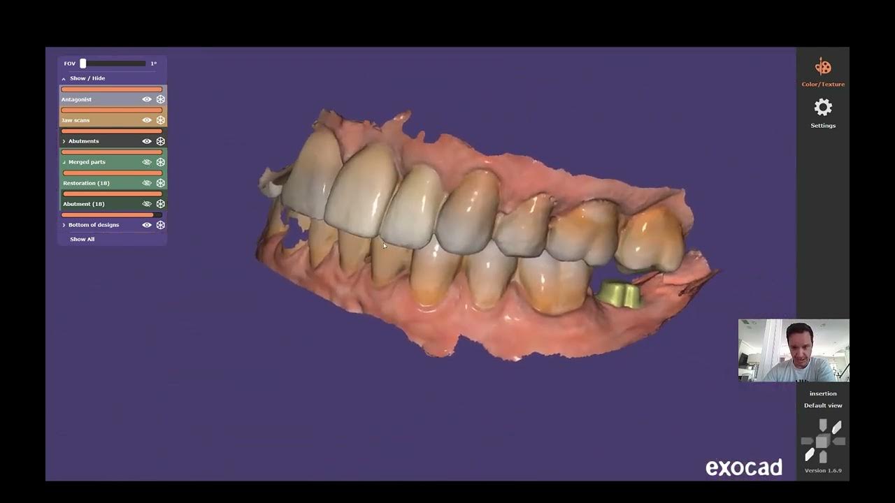 ExoCad Webview - YouTube