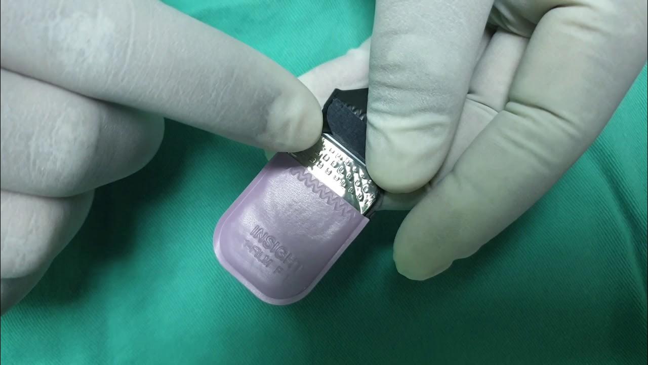 GNT208 - Inside the x ray film - YouTube GNT208 - Inside the x ray film - YouTube