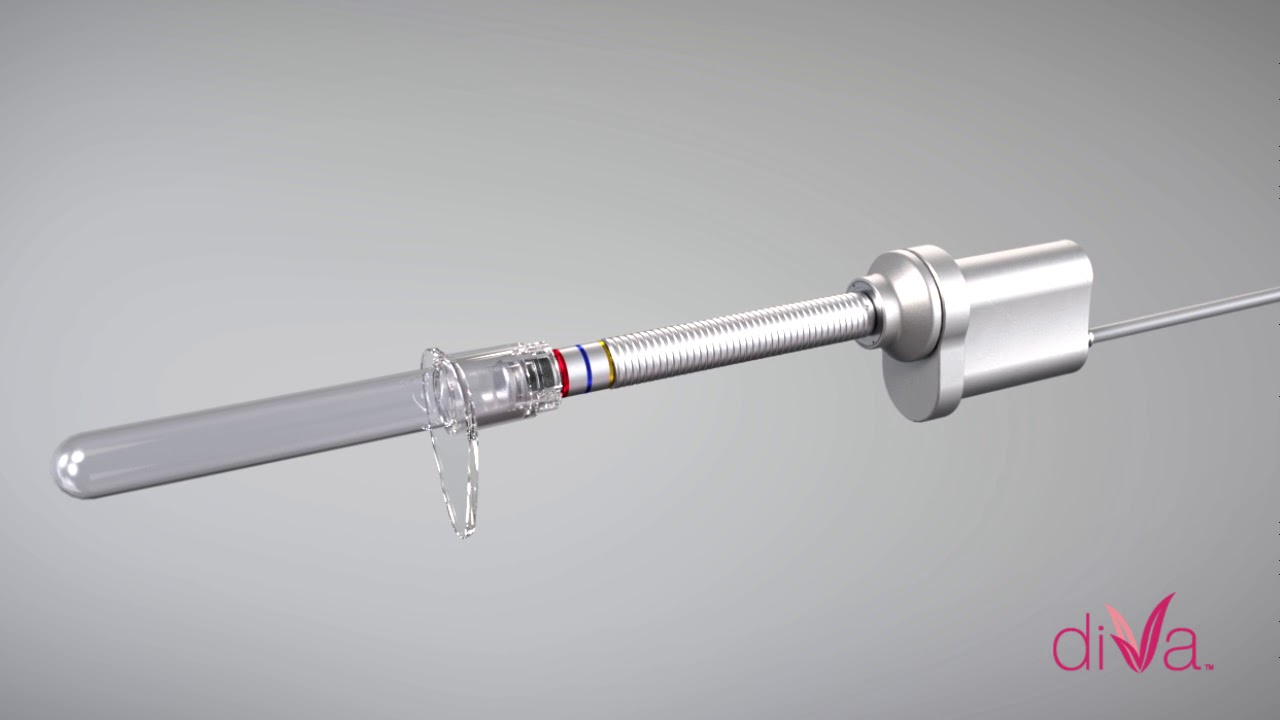 Diva laser vaginal rejuvenation - YouTube