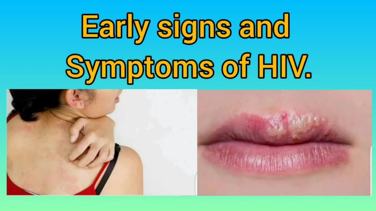 12 Early Signs And Symptoms Of Hiv Infection Youtube