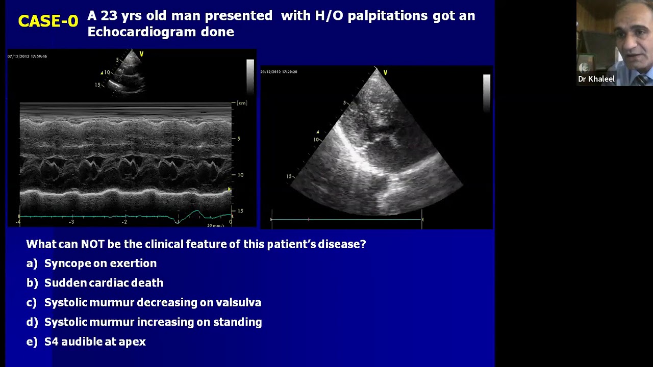 TOACS 45, Interactive TOACS ( M-mode Echo ) Session for FCPS Cardiology ...