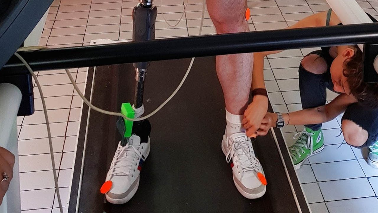 Bionic leg allows amputees to "feel" their legs again - YouTube