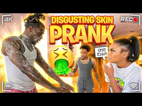 DISGUSTIN PEELING SKIN PRANK ON LEX AND JACK - YouTube