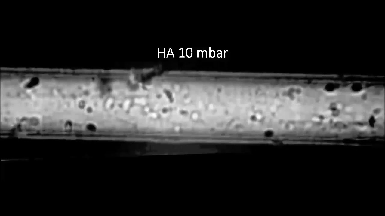 Sheathless Microflow Cytometry Using Viscoelastic Fluids - YouTube