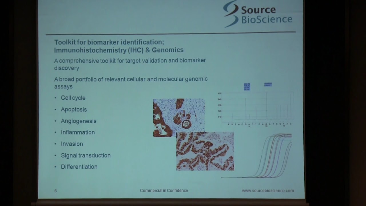 講演4： Source BioScience plc - YouTube