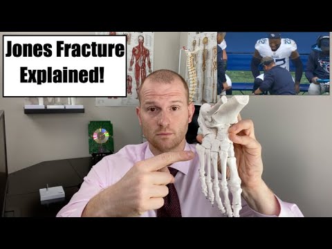 Derrick Henry Injury Update! - Derrick Henry Foot Injury Explained ...