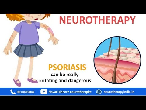 Skin Disease |Cause. Symptoms & #Neurotherapy Treatment of #Skindisease ...