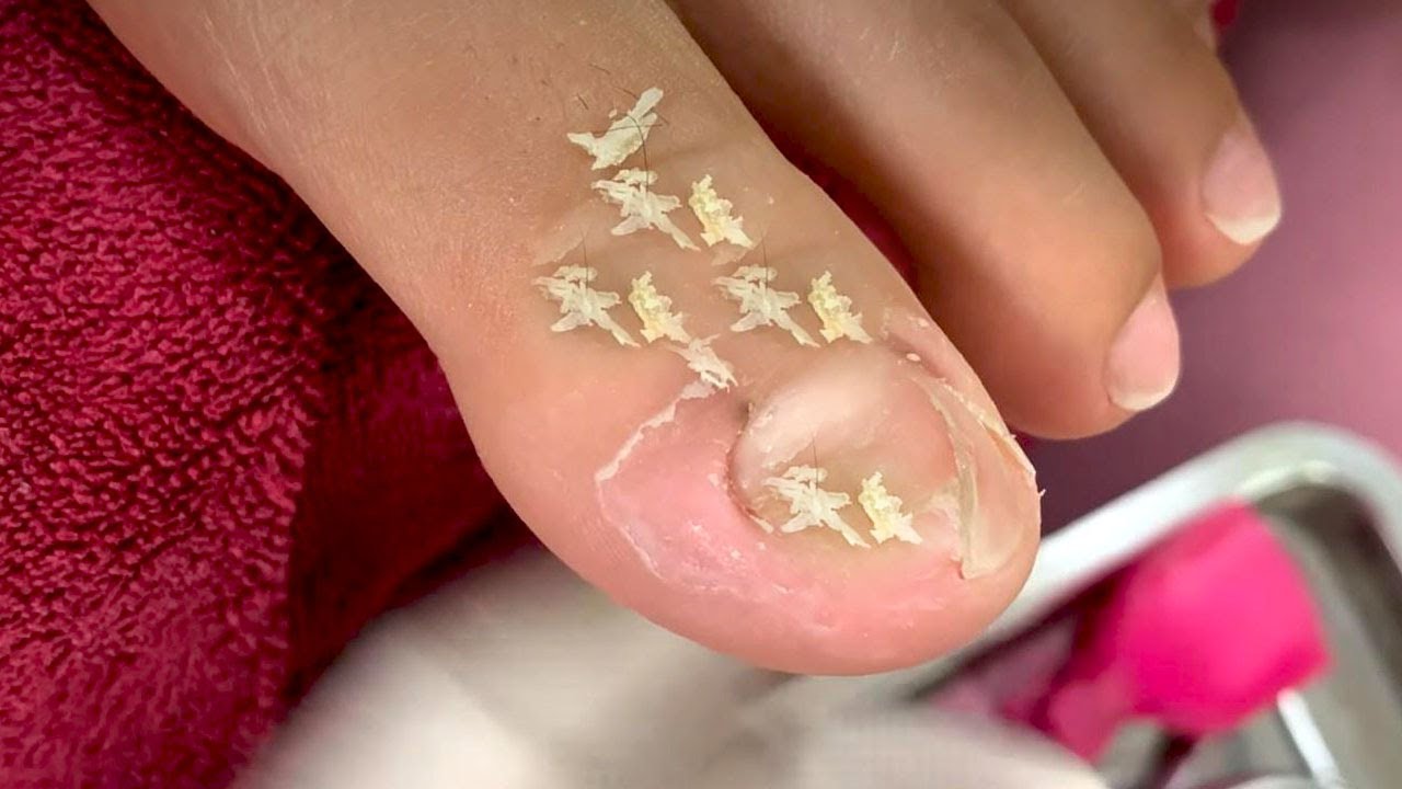 How to Repair Nails easy #352 - YouTube
