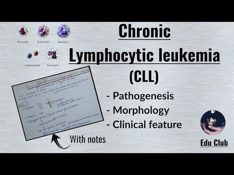Chronic Lymphocytic Leukemia(CLL) | Small lymphocytic lymphoma(SLL) || Pathology - YouTube