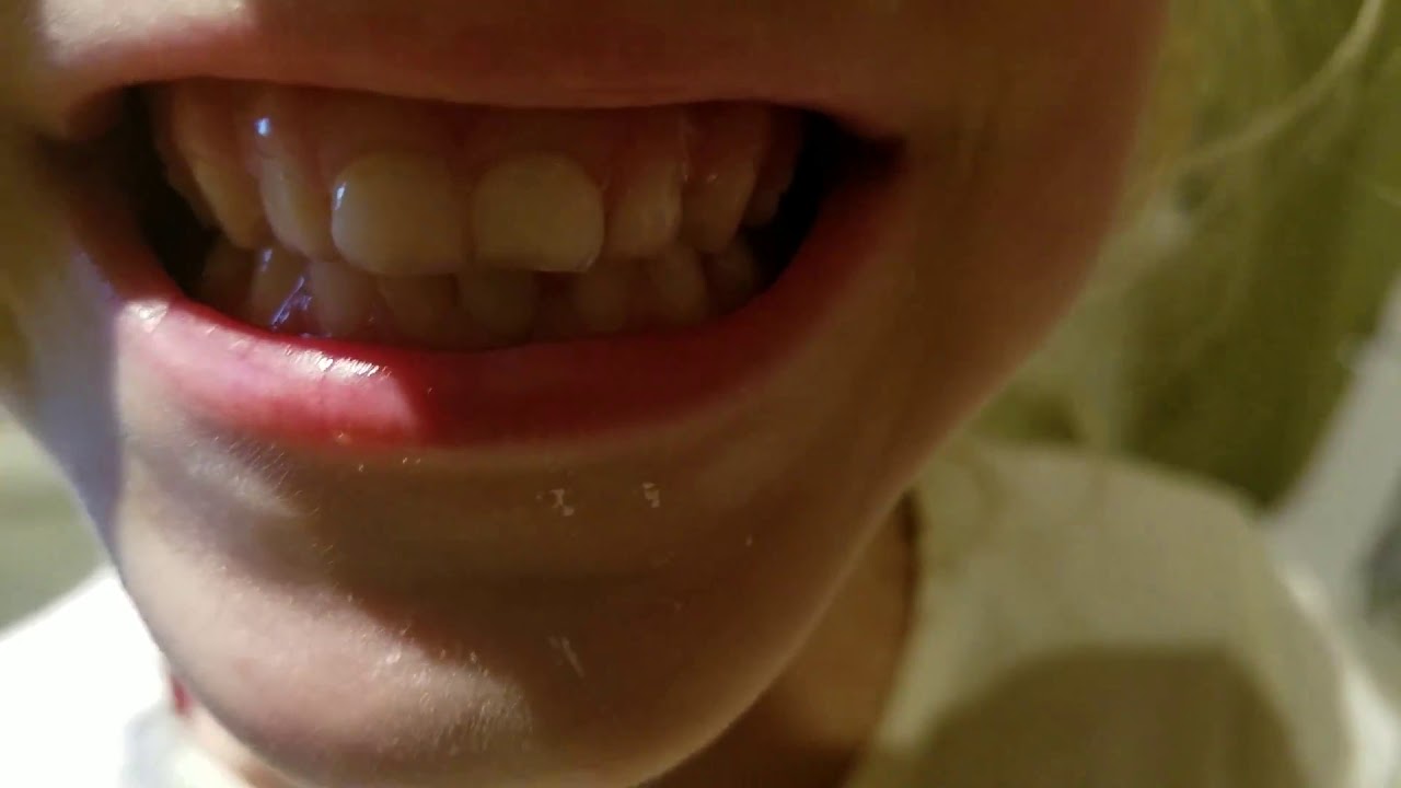 Bendy tooth - YouTube