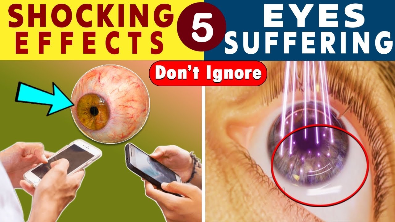 Hidden Dangers of Screen Addiction Shocking Effect On Eye Health - YouTube