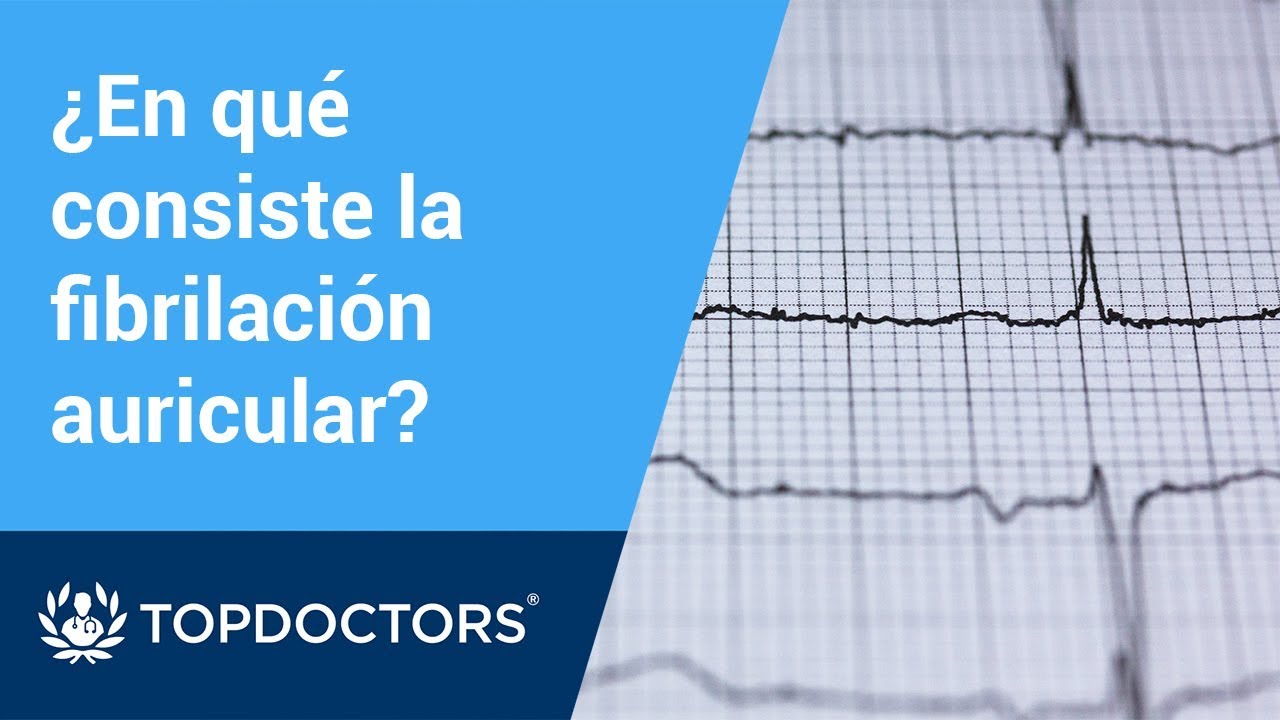 ¿En qué consiste la fibrilación auricular? - Dr. Pedro Javier Serrano ...