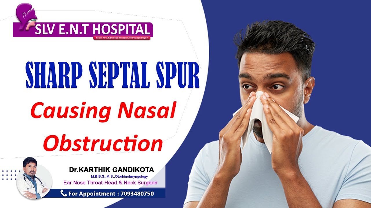 Sharp Septal Spur Causing Nasal Obstruction - YouTube