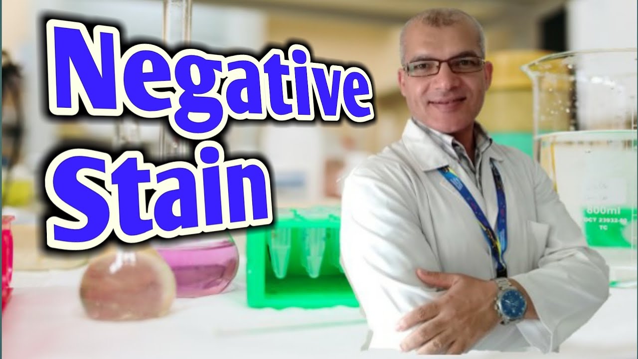 Bacterial Negative Stain Procedure - YouTube