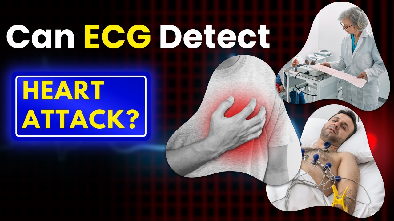 Can ECG detect Heart Attack ? | When and Why to get a ECG done - YouTube