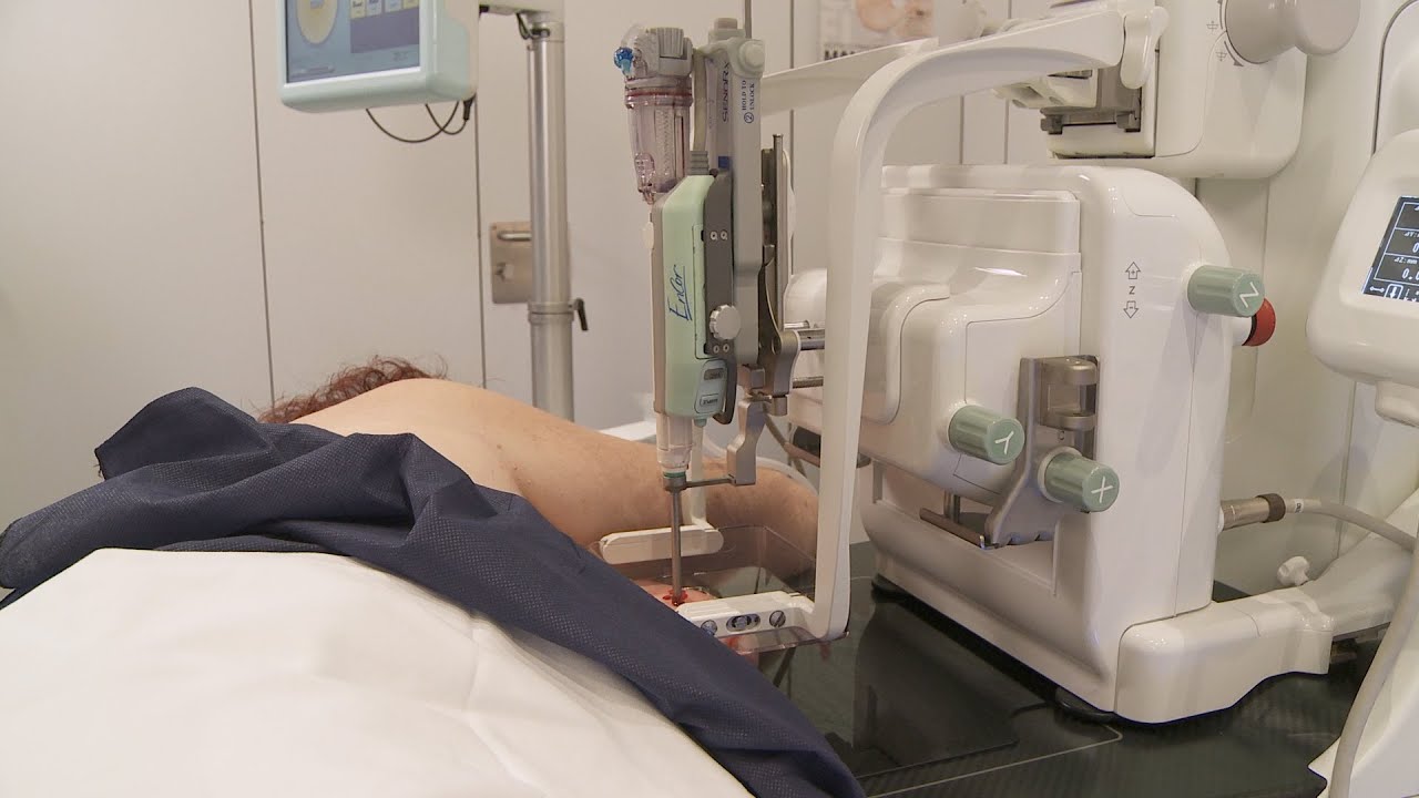 Biopsy Clinical Case EnCor and Fuji Amulet - BD Europe - YouTube