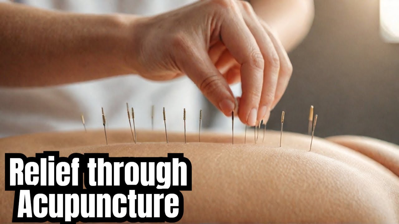 The Life Of A Acupuncturist - YouTube