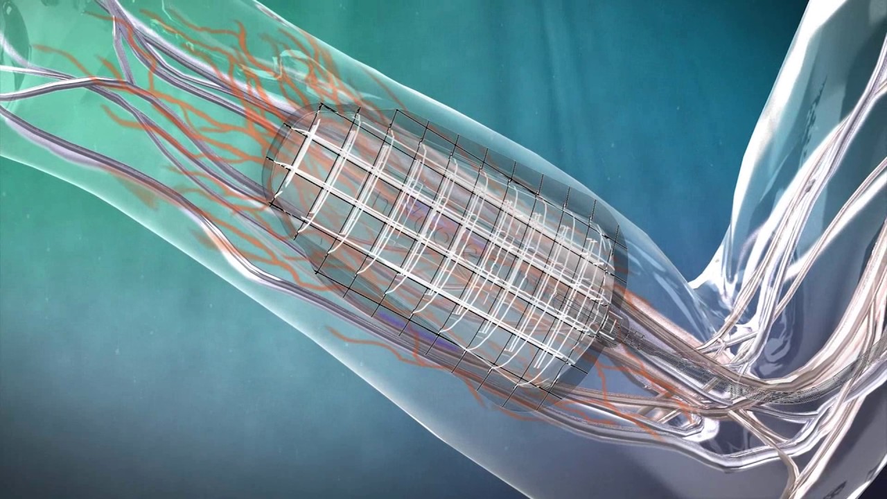 Wireframe Medical Animation - YouTube