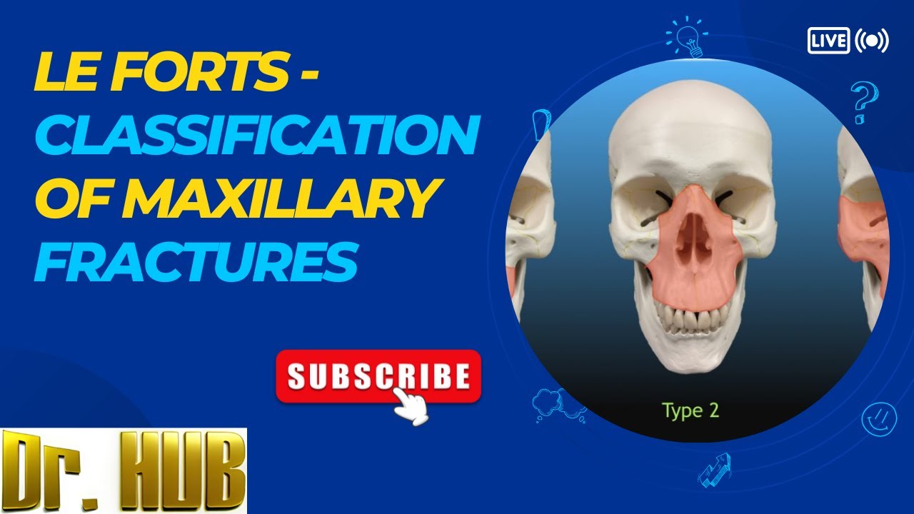 Le forts - classification of maxillary fractures - YouTube