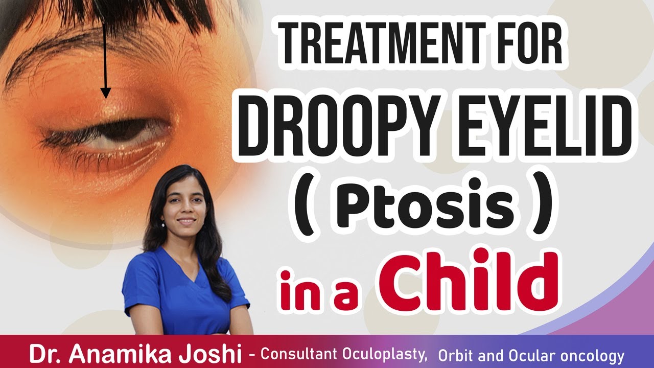 Treatment for Droopy eyelid ptosis in a child | Dr Anamika Joshi - YouTube