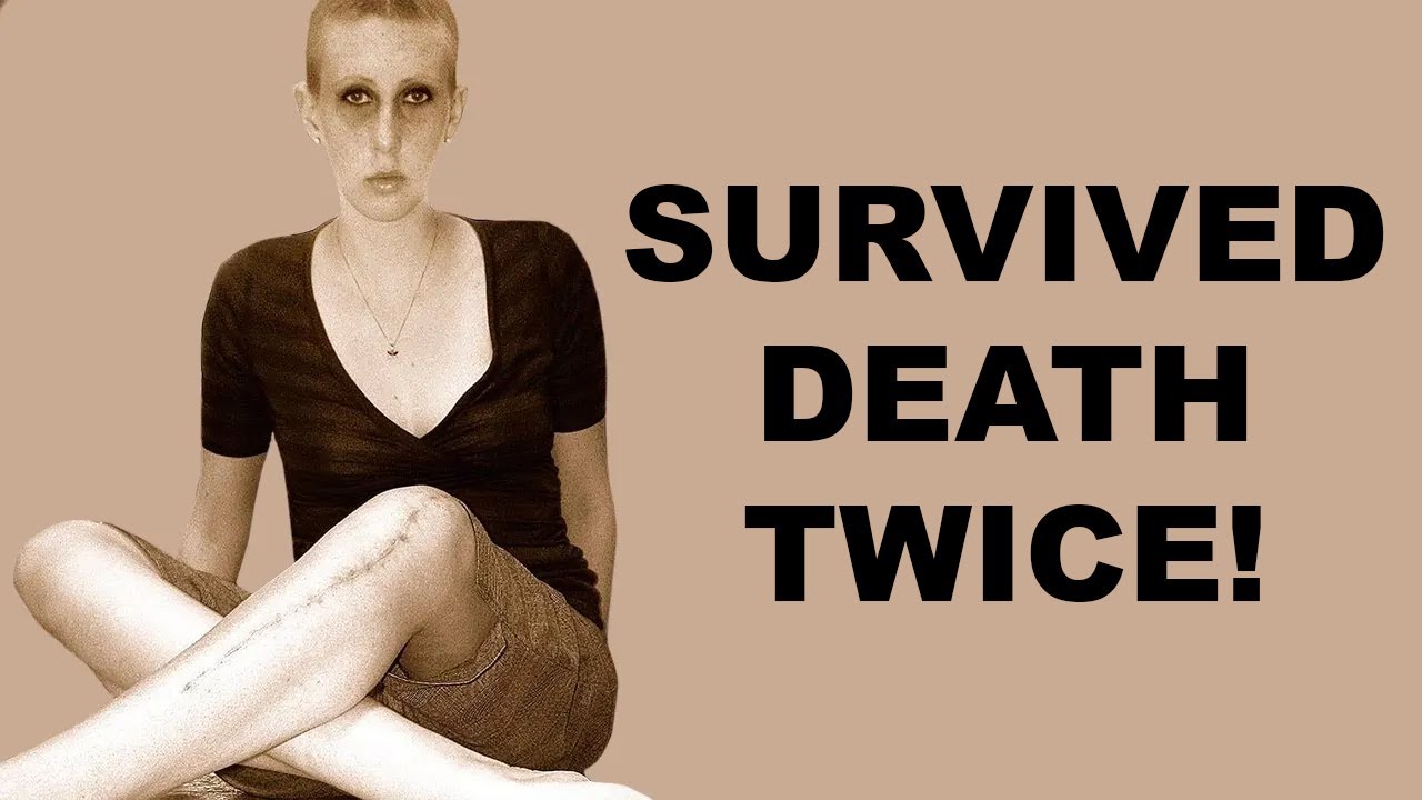My Experience with Osteosarcoma - Going Through & Beating Bone Cancer ...