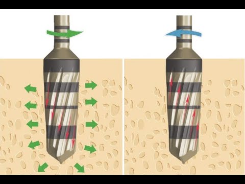 Osseodensification system in dental implant surgery - YouTube
