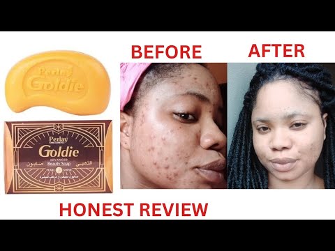 Parley Goldie Beauty soap review| perley goldie beauty lotion|Parley ...