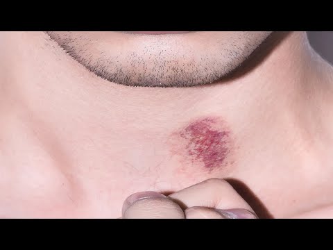 how to give someone a hickey on the neck simple
