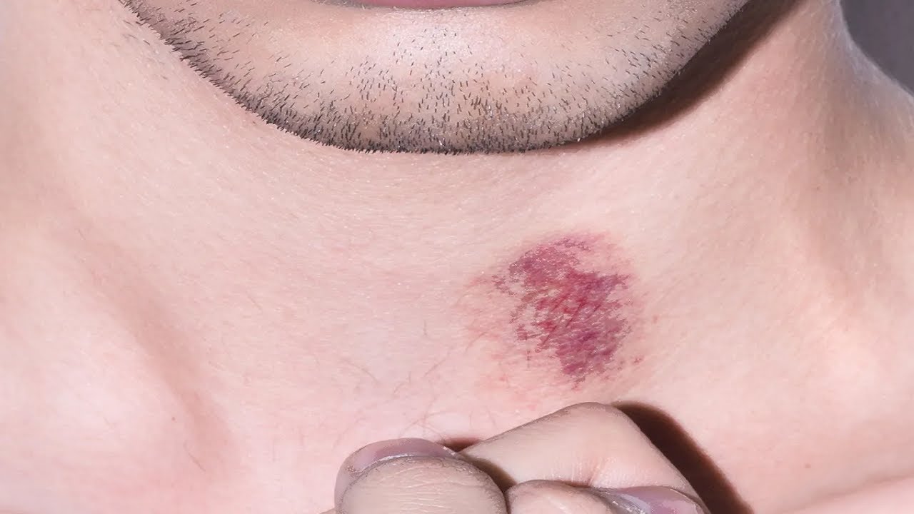 how to give someone a hickey on the neck simple - YouTube