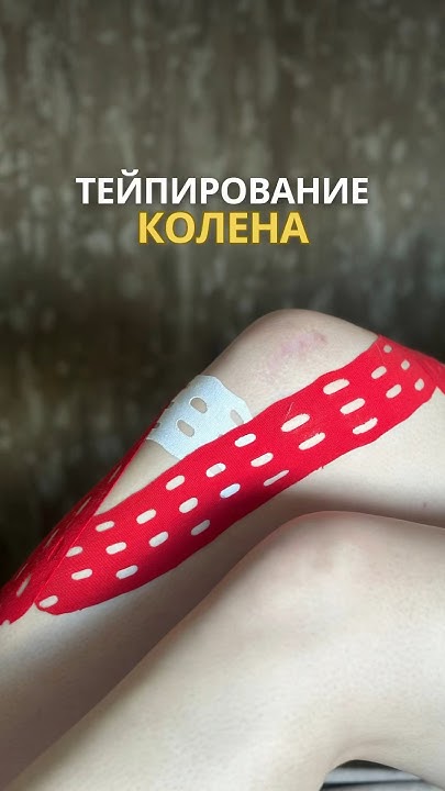 Тейпируем колено Мягкая фиксация при боли тейпирование массаж Youtube