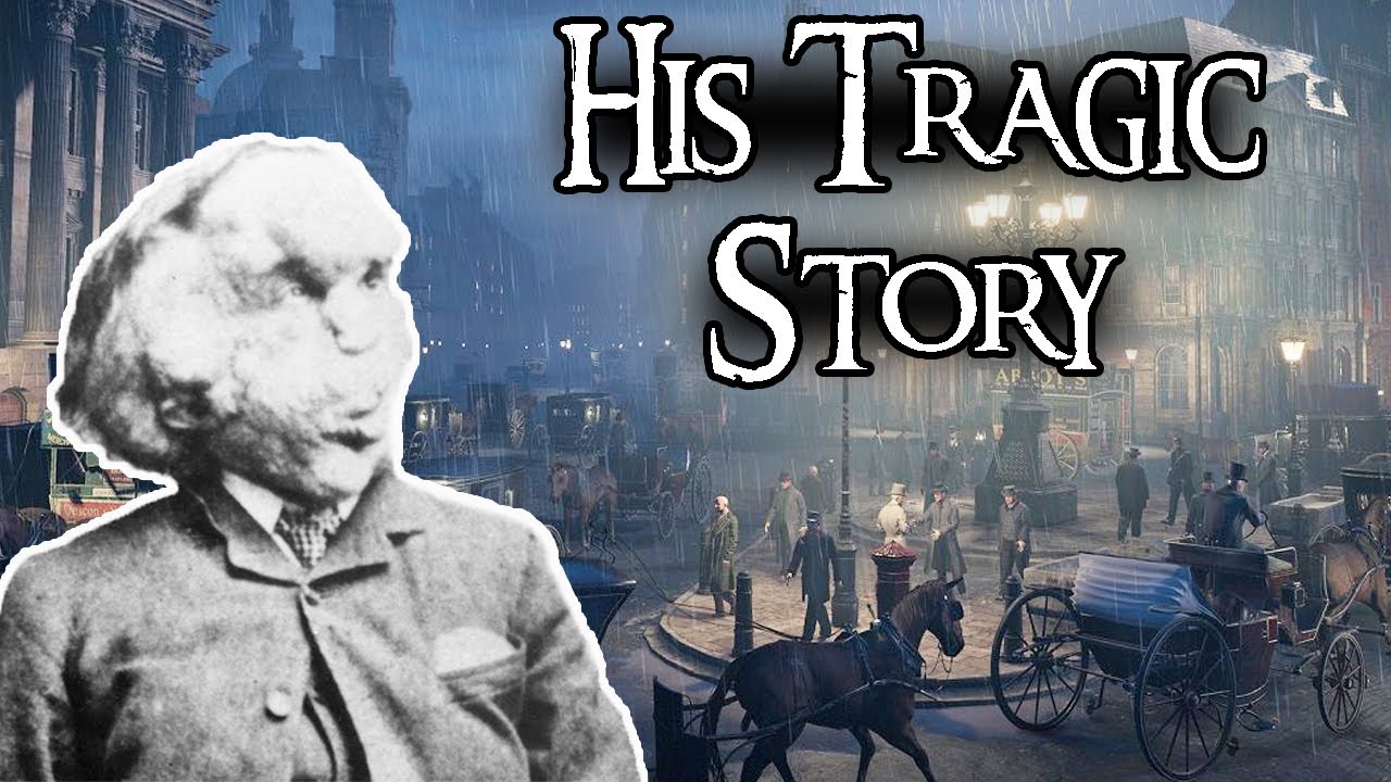 The Curious Case of The "Elephant Man" | Joseph Merrick - YouTube