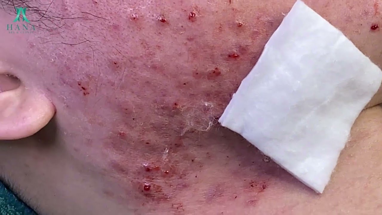 Satisfying Relaxation With Hana Spa #7 - YouTube