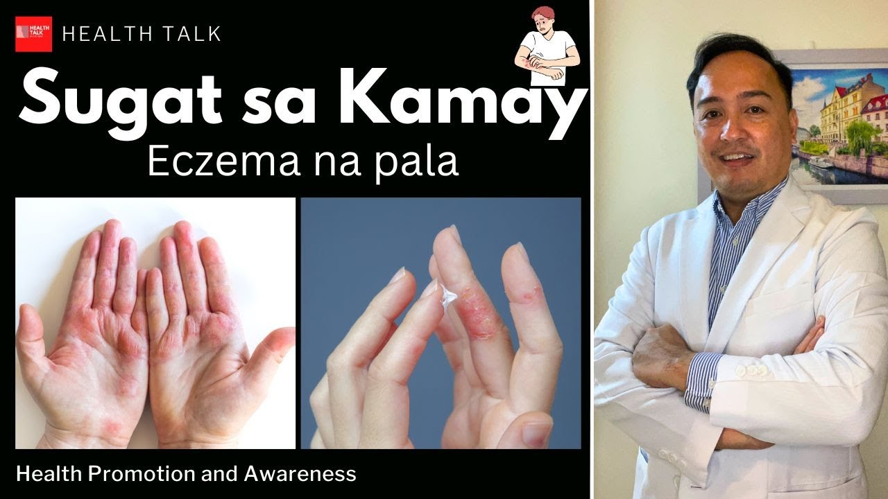 Eczema: Sugat sa kamay (Causes, Symptoms, Treatment and Prevention ...
