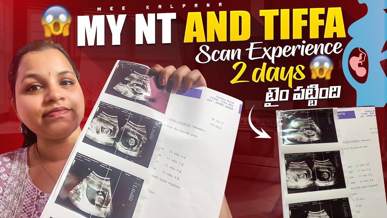 MY NT & TIFFA SCAN EXPERIENCE😱😱||FULL INFORMATION IN THIS VIDEO👍||MEE ...