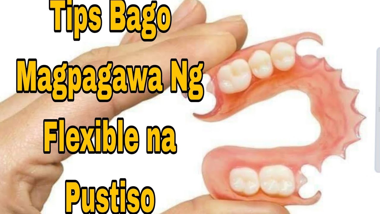 Tips Bago Magpagawa Ng Flexible na Pustiso #flexibledenture - YouTube