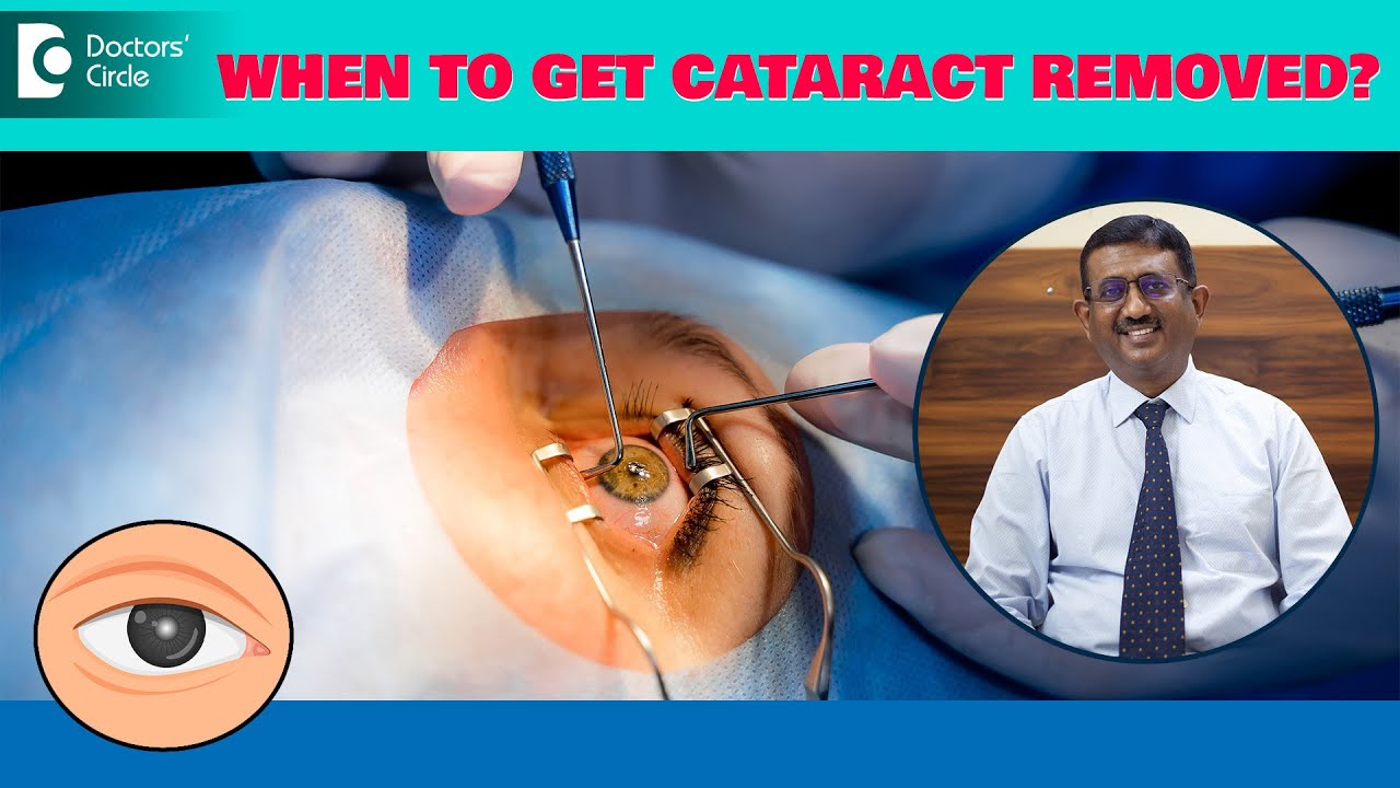 Hard Cataract Removal-Surgery | Cataract Awareness Month - Dr.Sriram ...