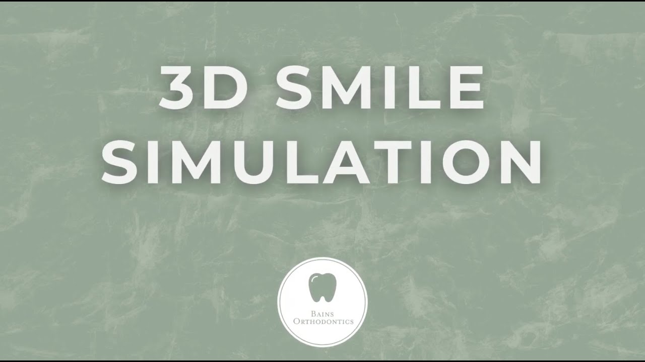 3D Smile Simulation! | Braces & Invisalign Orthodontist | Okemos, MI ...