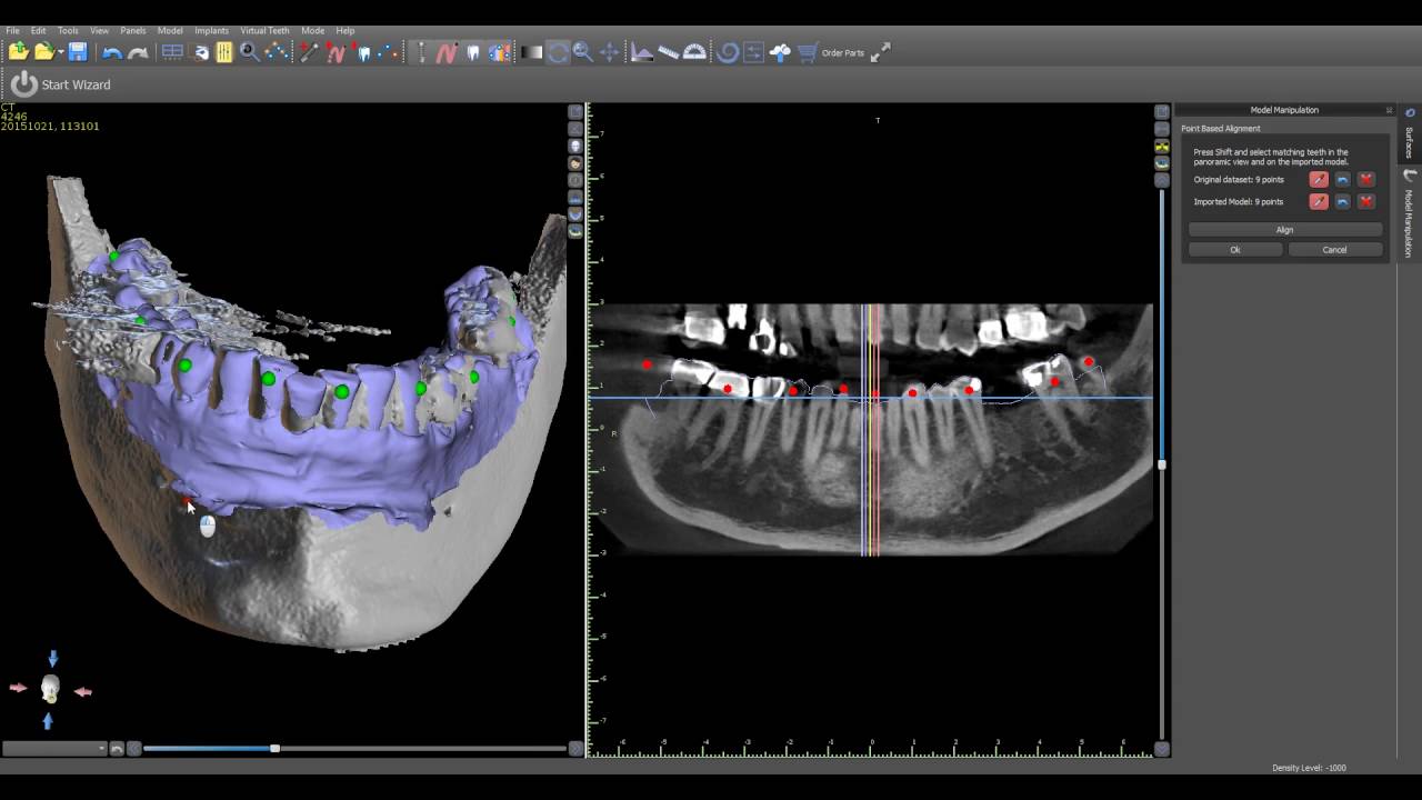 Review of Merge Functionality using "Matching Teeth" Technique - YouTube