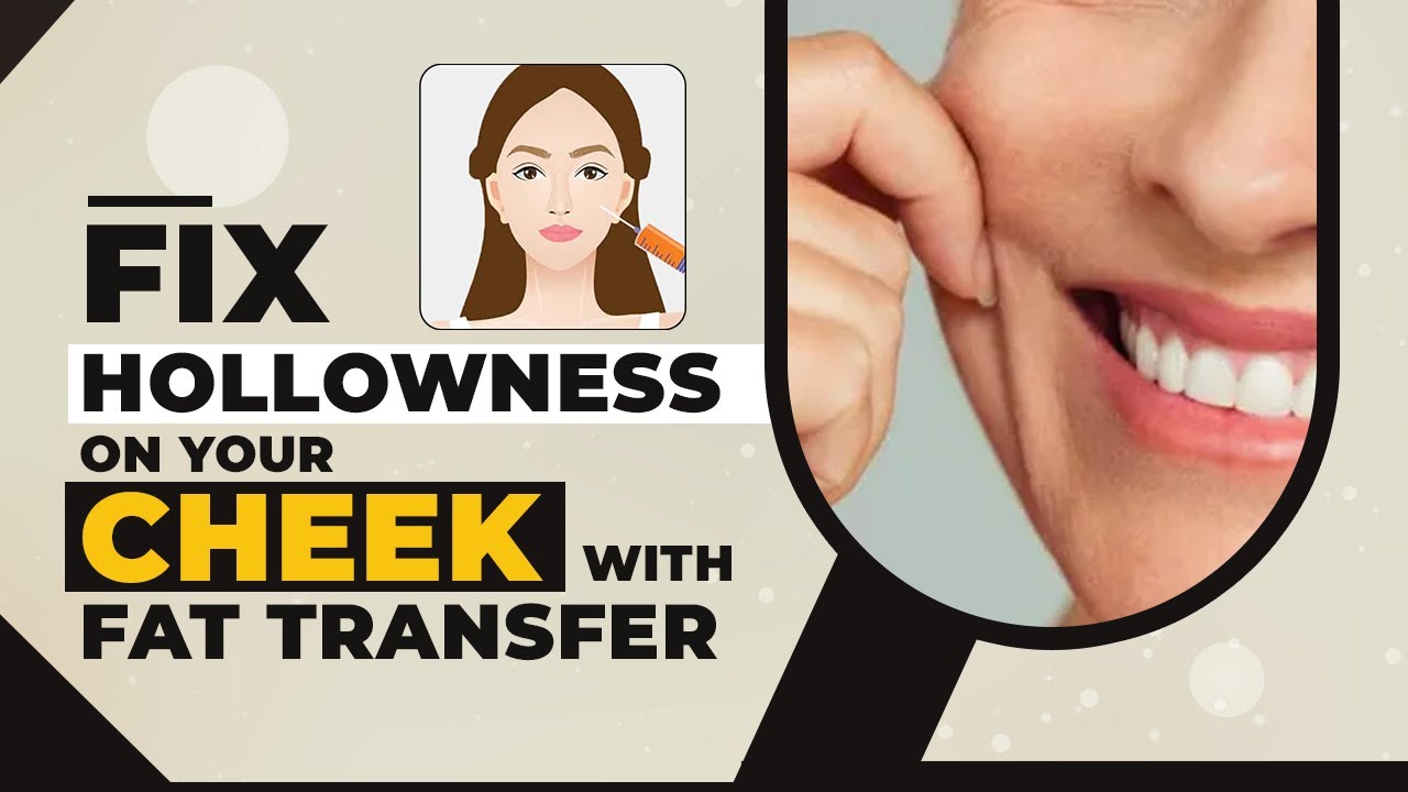 How to Correct Hollowness in the Cheeks? Reduce Hollowness in Cheeks ...