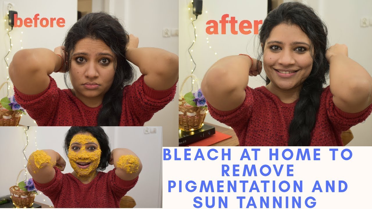 Bleach at home to remove pigmentation scars and sun tanning ...