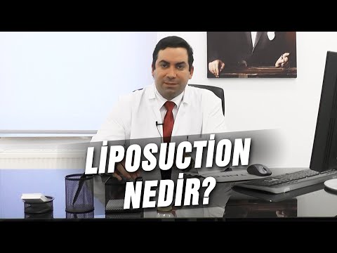 Liposuction nedir? Vücut şekillendirme nasıl yapılır?  |  Op. Dr. Ali Nevai
